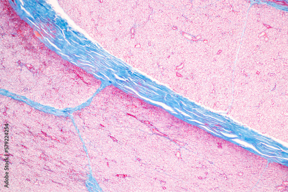 Anatomy and Histological Tonsil and Parotid Human cells under ...