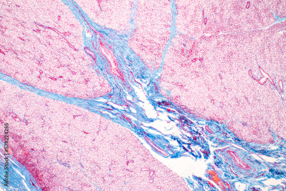Anatomy and Histological Tonsil and Parotid Human cells under ...
