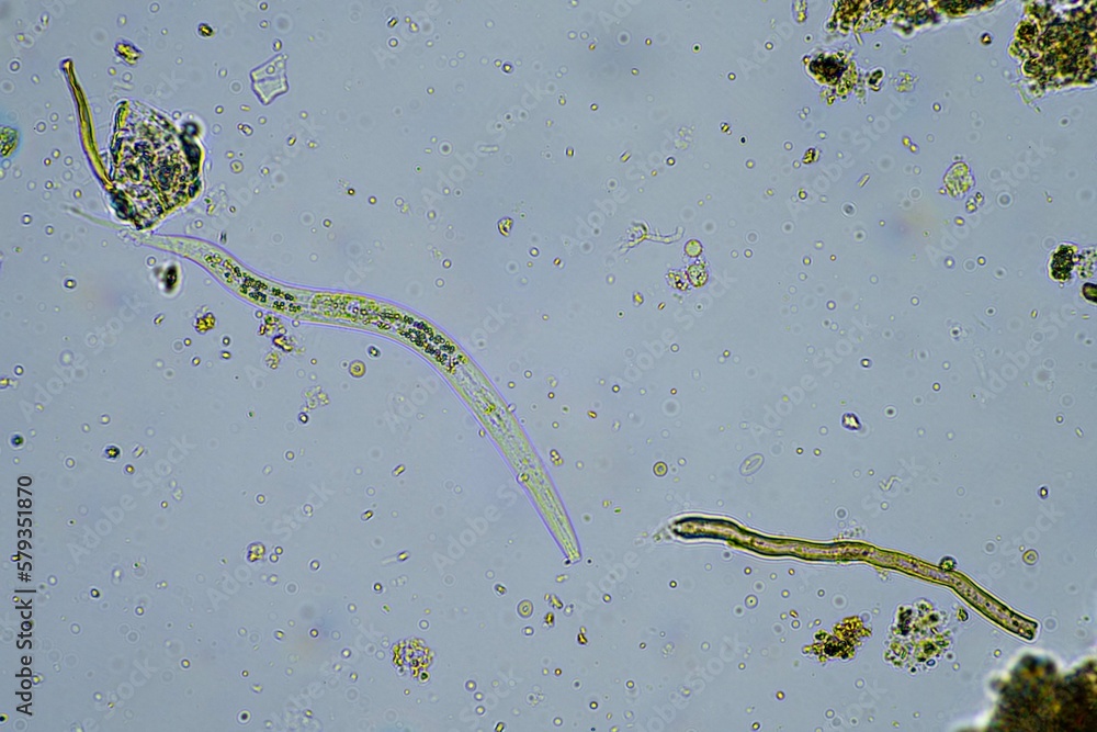 insect parasite in the soil in australia under the microscope Stock ...