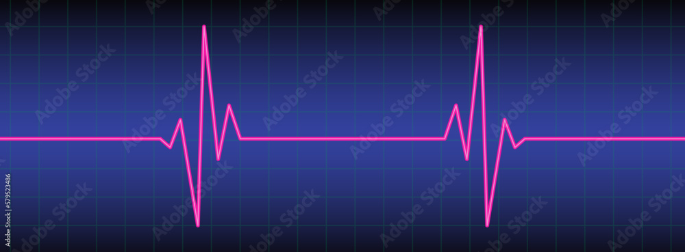 Vecteur Stock 3d ecg, ekg monitor with cardio diagnosis. Heart rhythm ...