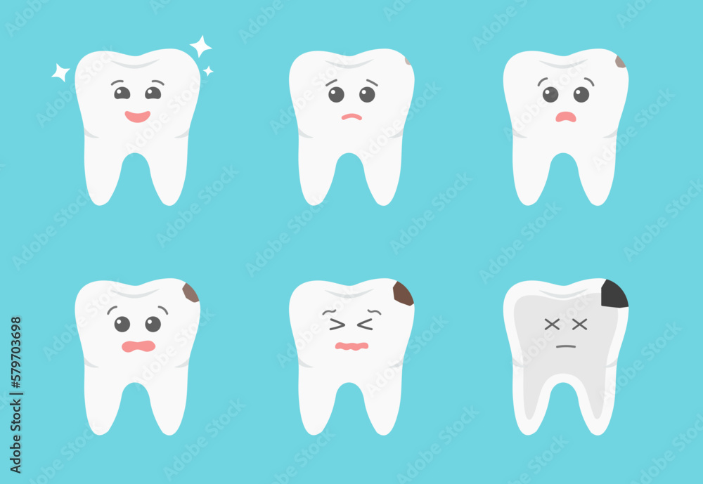 Cute teeth. Stages of tooth decay in flat style. Stages of caries with ...