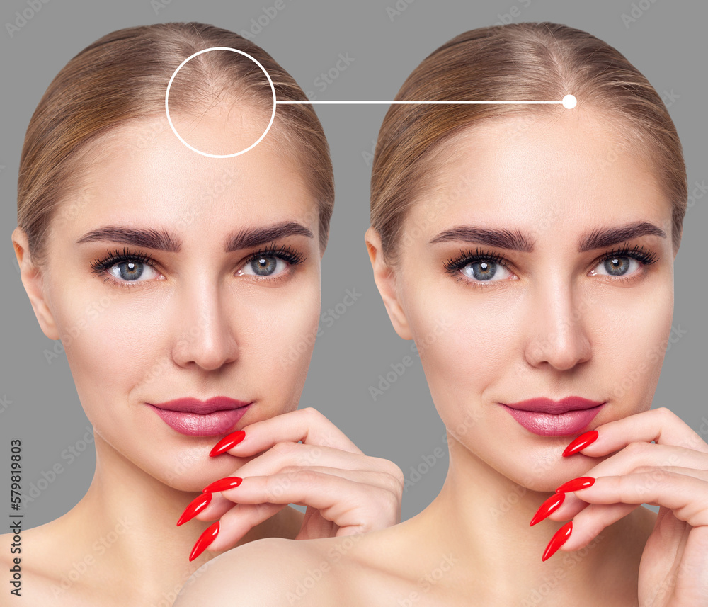 Beautiful woman before and after hair treatment. Stock Photo | Adobe Stock