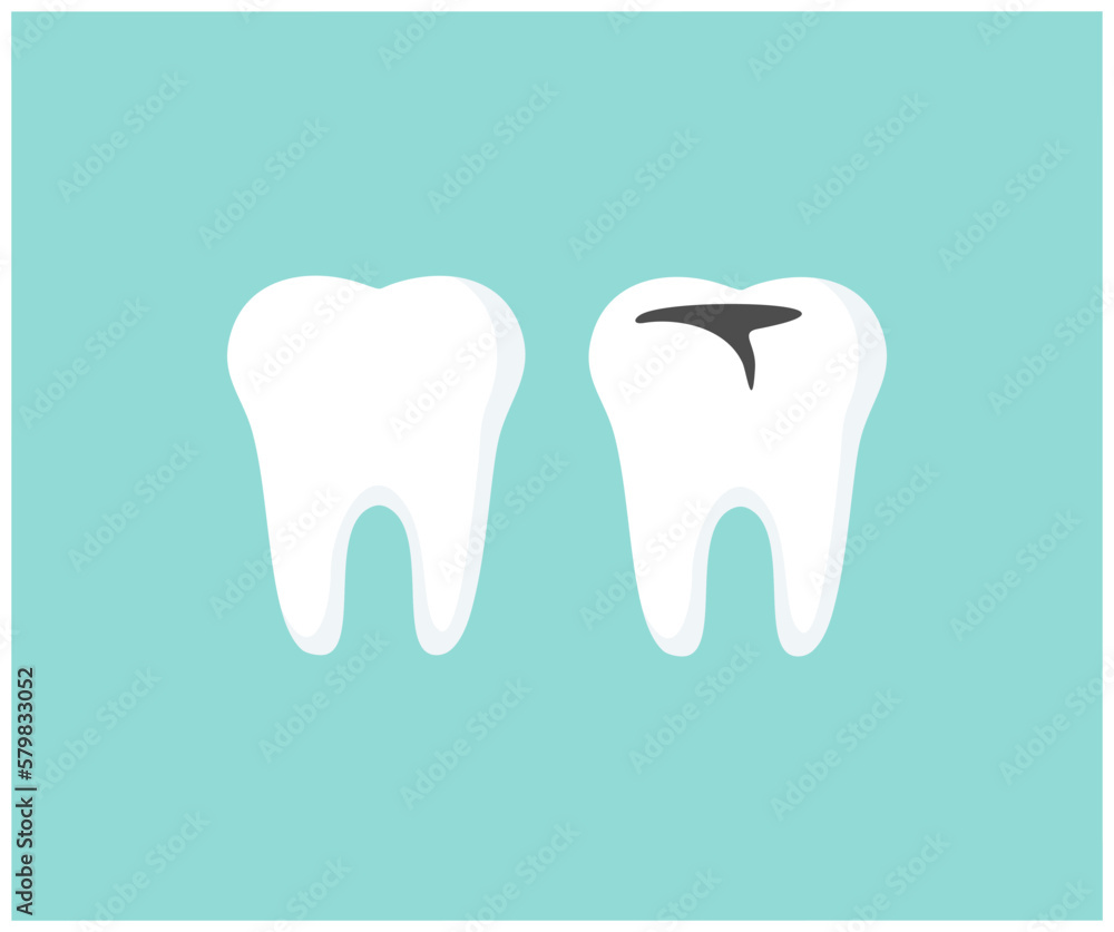 Shiny, healthy tooth and tooth with decay logo design. Concept ...