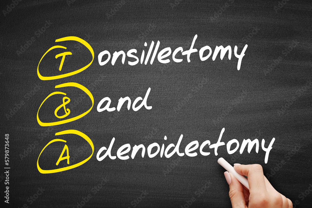 T&A - Tonsillectomy and Adenoidectomy acronym, medical concept ...
