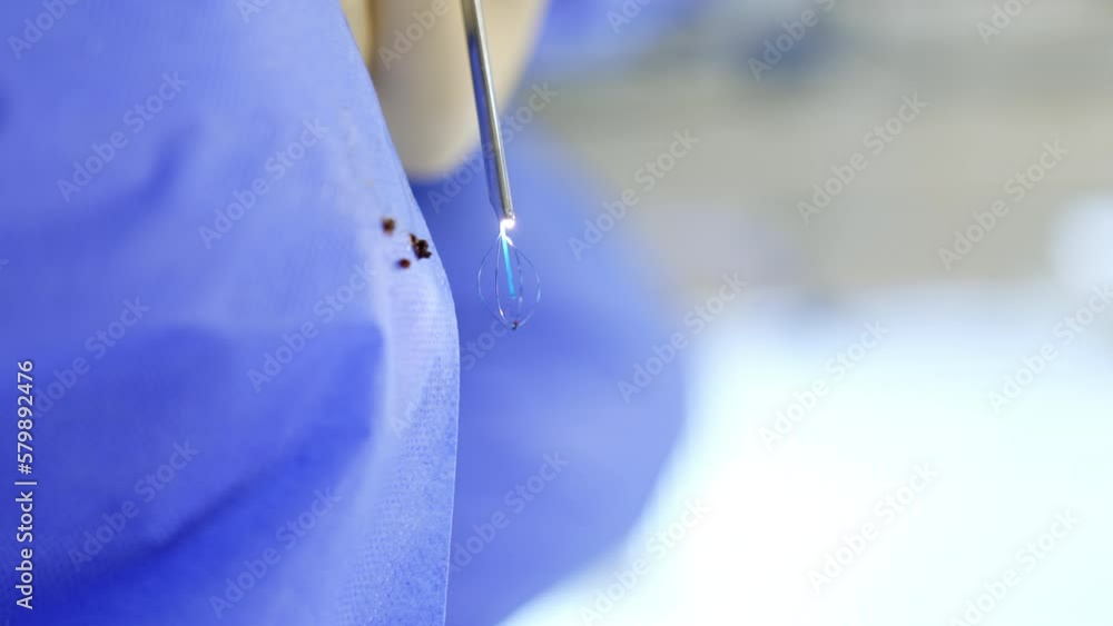 Flebogrif device for closing of large and small subcutaneous veins ...