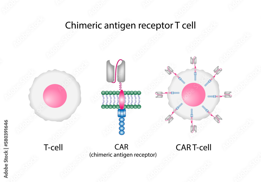 T-cell and Chimeric antigen receptor T cell ,CAR T cell, for use in immunotherapy. chemotherapy ...