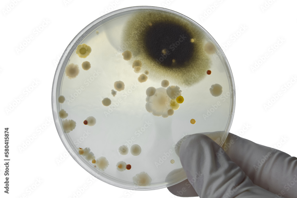 Hand with Petri dish or culture media with bacteria on white background ...