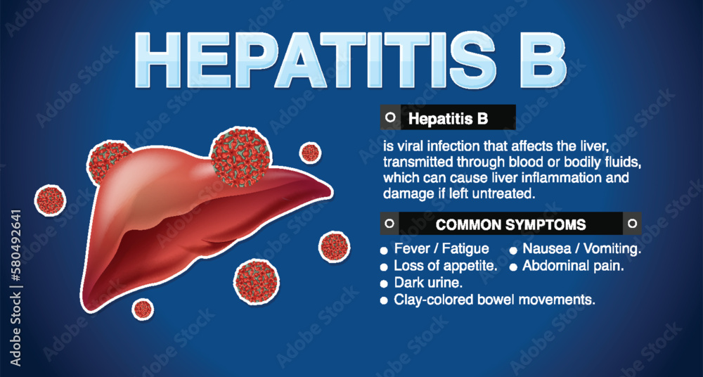 Symptoms of Hepatitis B Infographic Stock Vector | Adobe Stock