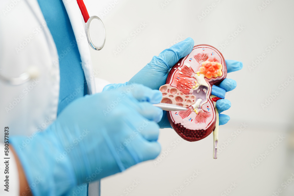 Chronic kidney disease, doctor holding model for treatment urinary ...