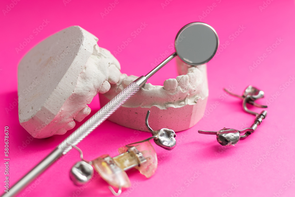 Foto de Dental models top view. Jaw models with different problems ...