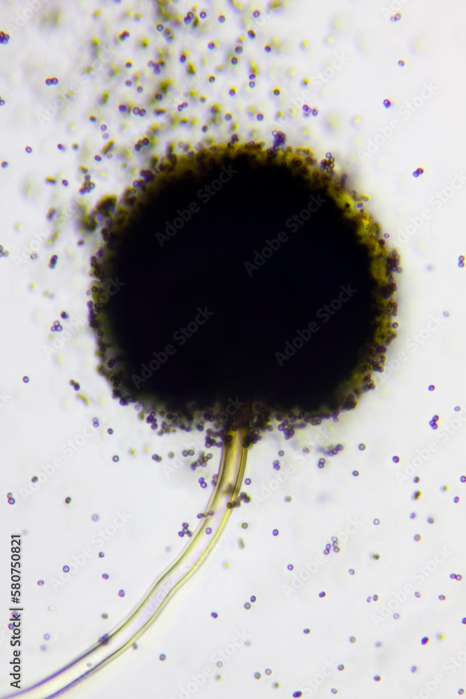 Microscopic view of a conidial head of Black mold (Aspergillus niger ...