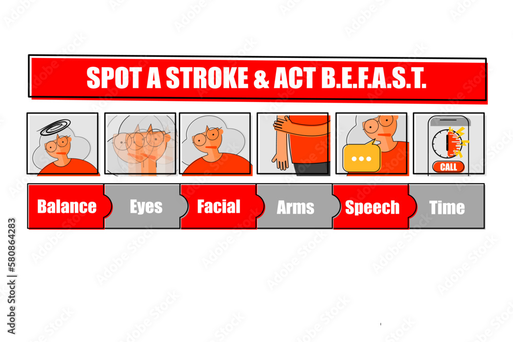 Spot a stroke and act BEFAST, acute stroke syndrome assessments. Stock ...
