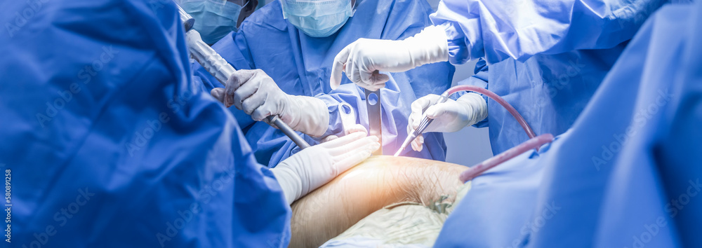 Panorama banner inside operating room.Doctor and team of nurse doing ...