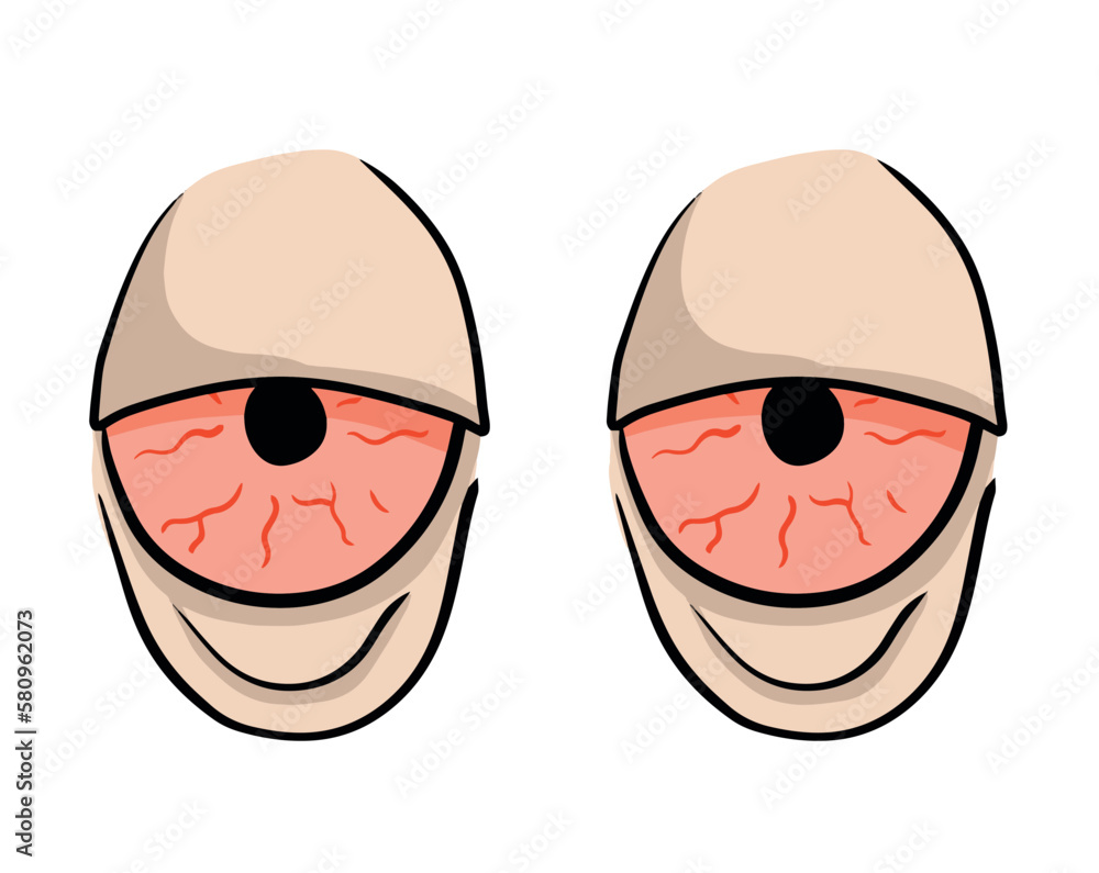 Red hand-drawn eyes. Problem of insomnia. Sleep disorder with ...