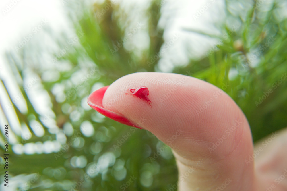 injured finger with a bleeding open wound on a background of green pine ...