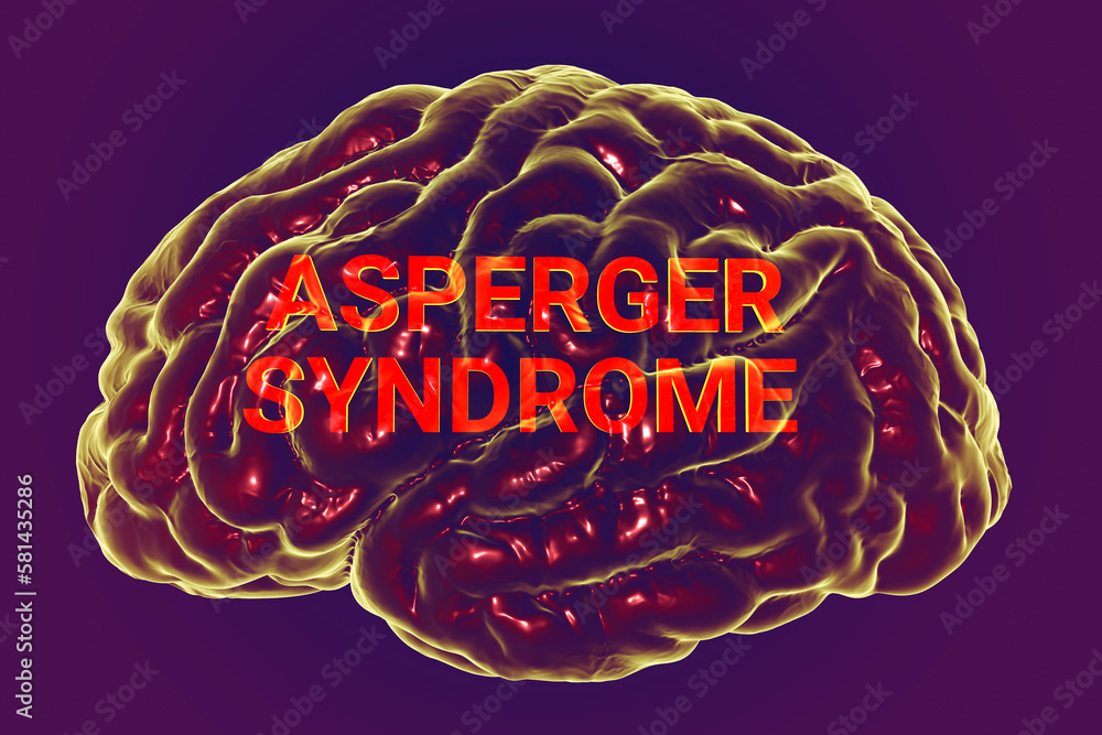 A conceptual 3D illustration featuring the text Asperger Syndrome ...