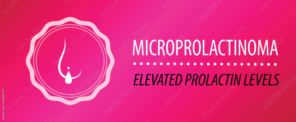 Microprolactinemia elevated prolactin design illustration Stock Vector ...