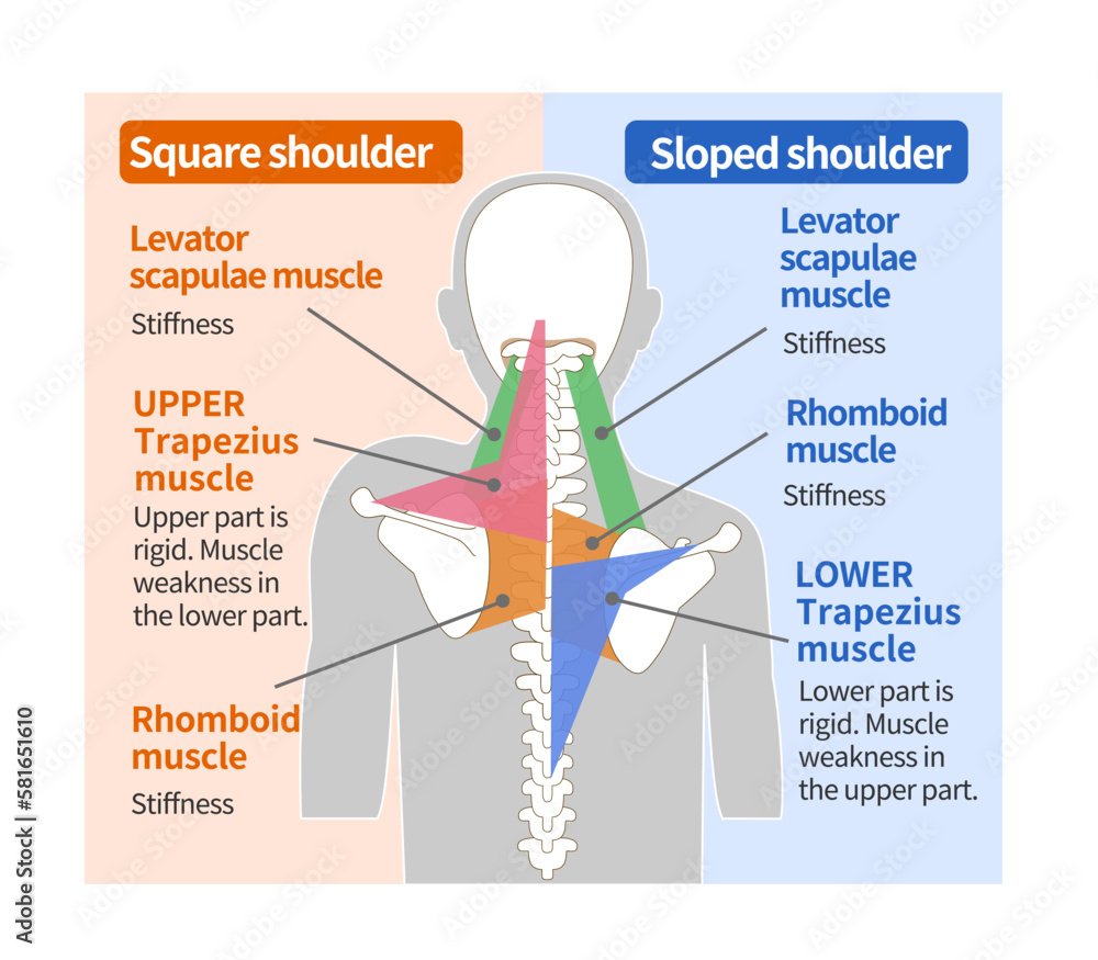 Muscular structure of the square shoulder and sloped shoulder Stock ...