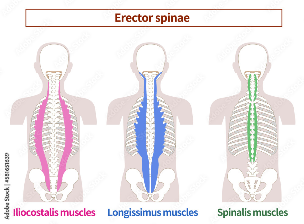 Illustration of the anatomy of the erector spinae muscle Stock Vector ...