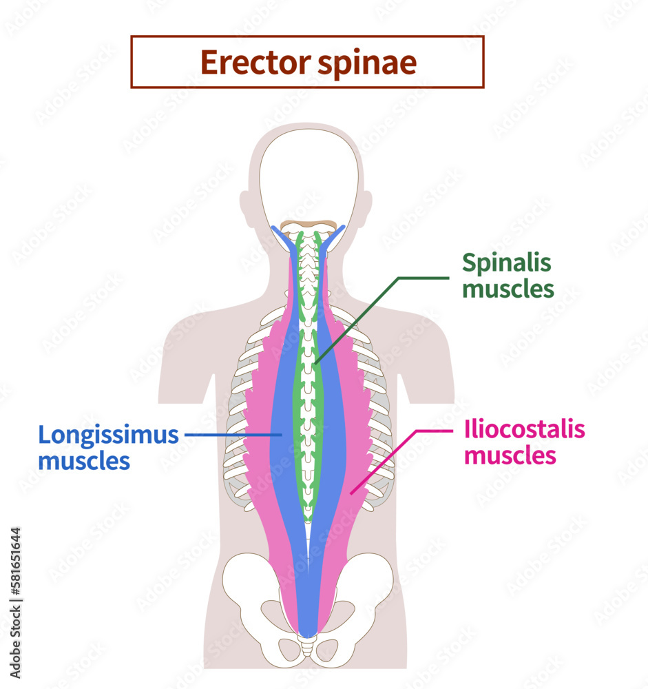 Poster Illustration of the anatomy of the erector spinae muscle – Muurposter | Europosters