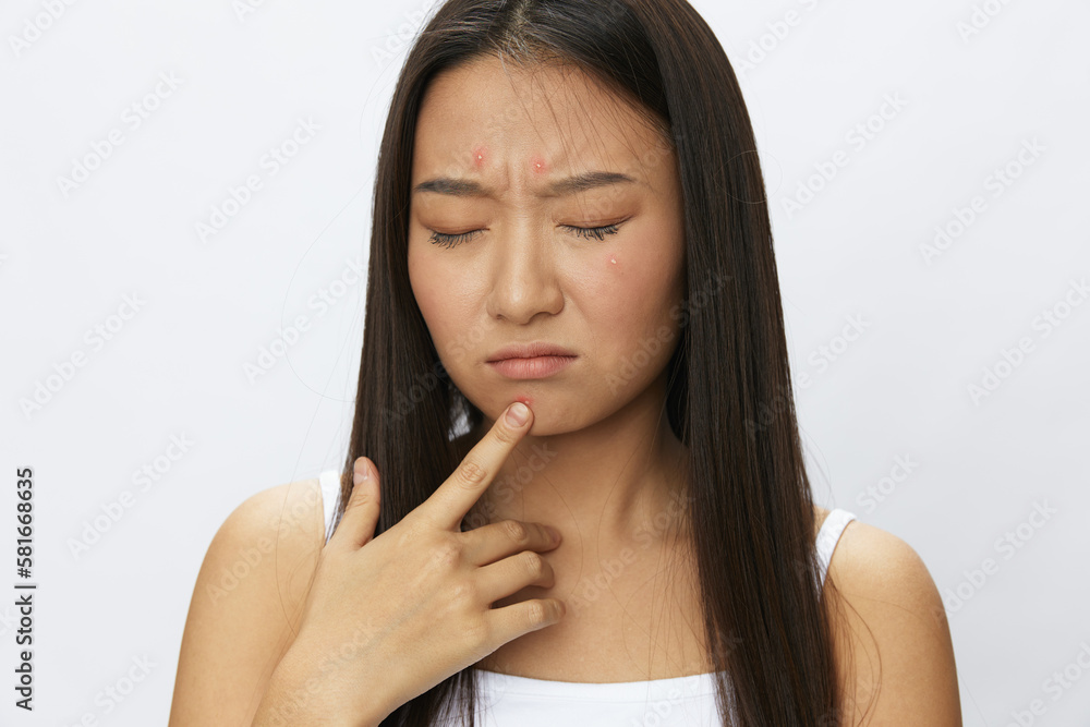 Asian woman facial skin problems, acne and inflammation, red rashes and ...