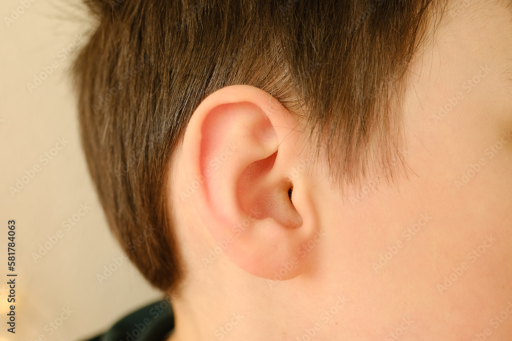 ear of small patient, child 8-10 years old, part face in profile close ...