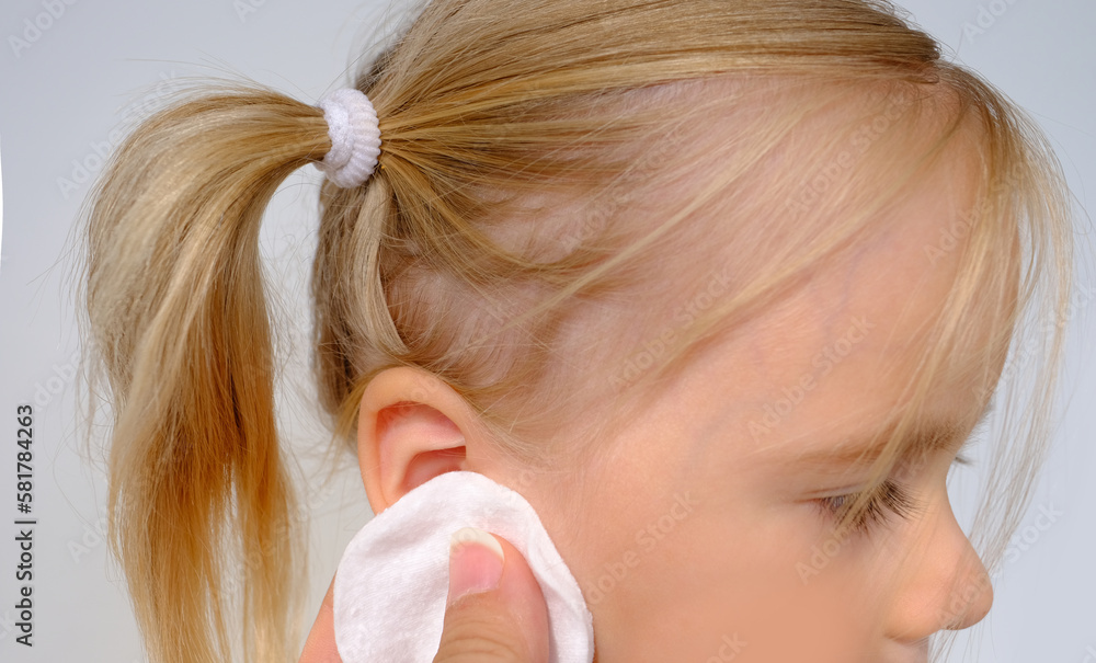 ear small patient, child, girl 3 years old, part face in profile close ...
