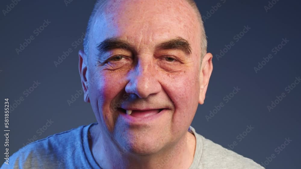 Elderly man puts false teeth into his mouth. Periodontal disease and ...