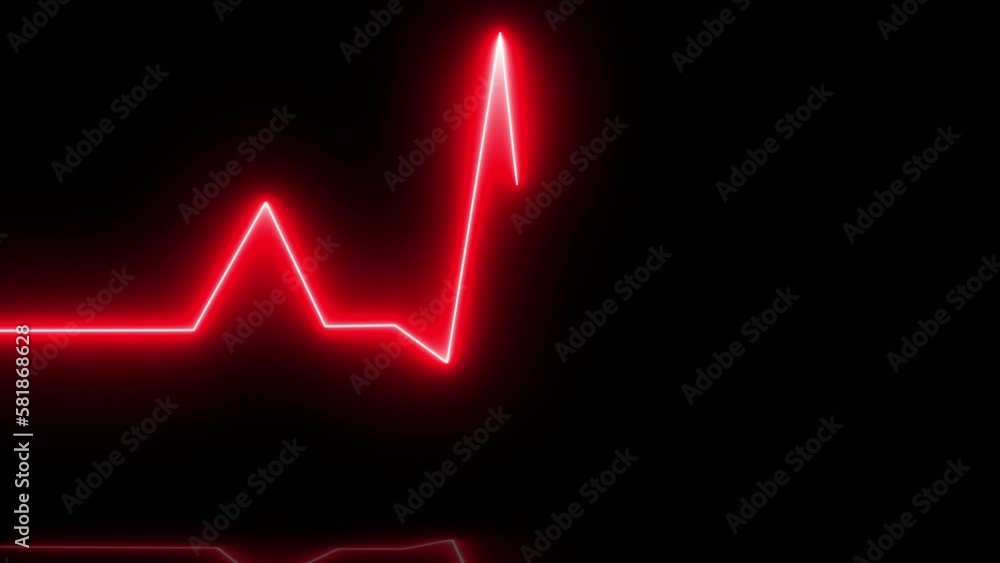 Heartbeat flatline animation. Seamlessly looping animation. Electro ...