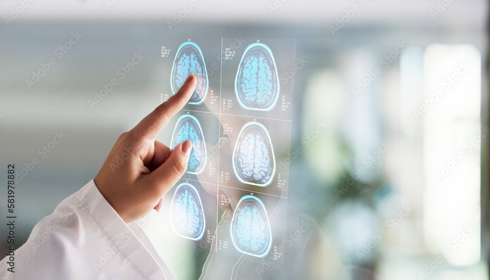 Brain x ray, digital clinic results and doctor hands with report ...