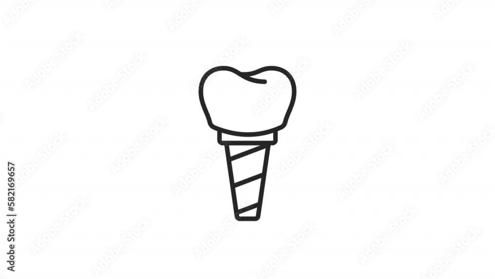 Animated implant linear icon. Endosseous prothesis. Professional dental ...
