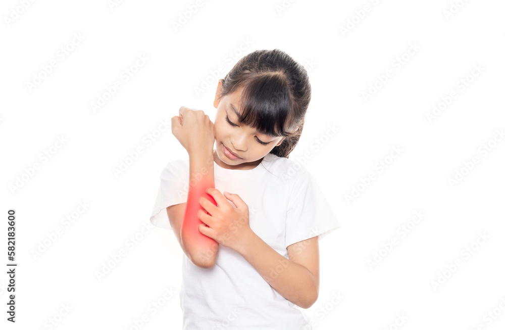 Poster Little girl has skin rash allergy and itchy on her arm isolated ...