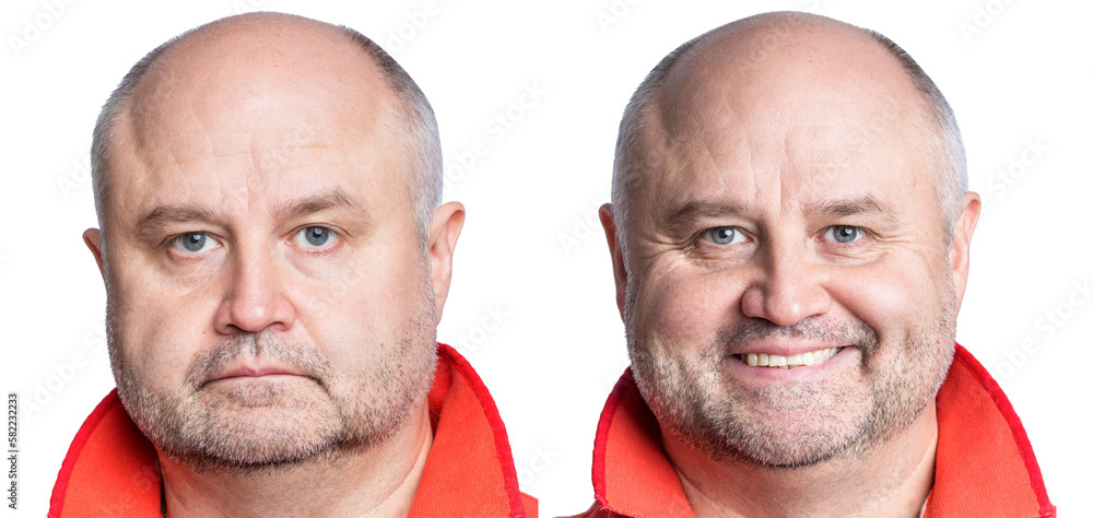 Serious and laughing face of an adult bald man close-up. Emotions and ...