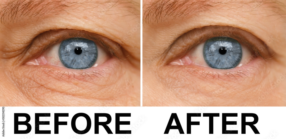 close up part of face mature woman 55 years old, human eye, lower ...
