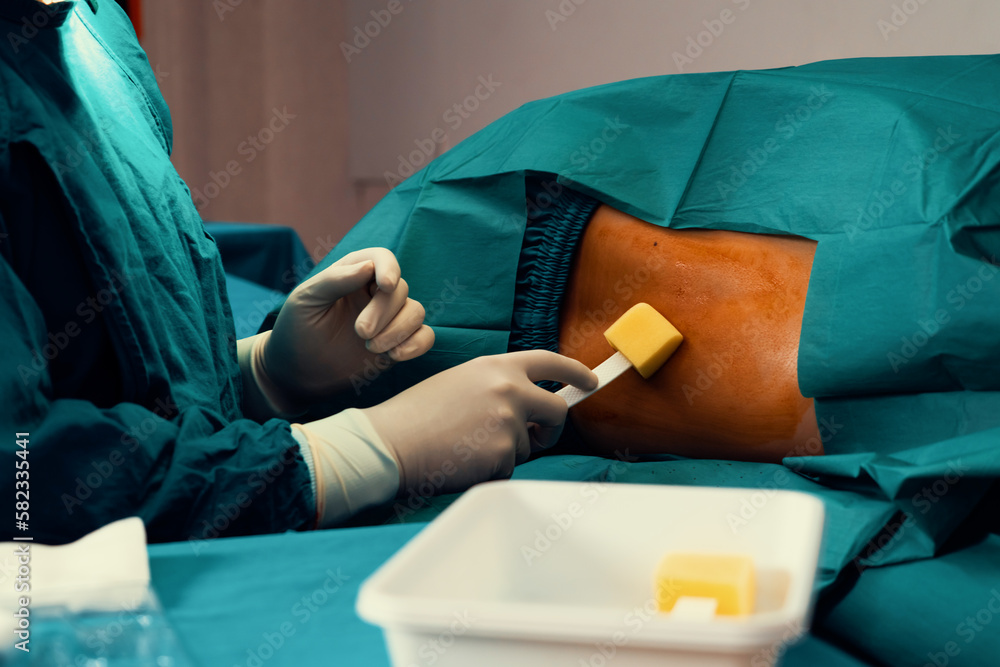 Doctor or surgeon apply betadine to the patient for anesthesia ...