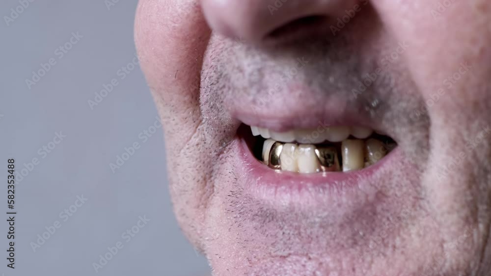 Close up, Smiling Elderly Male Pensioner with False Dentures and Golden ...