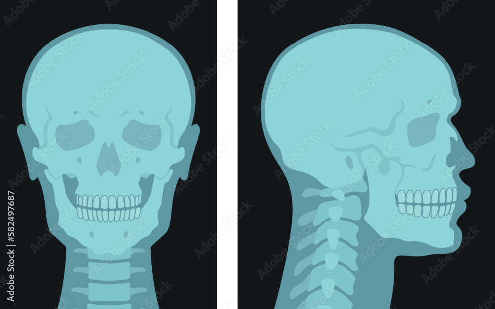 X rays shots of human skull front side view set vector flat ...