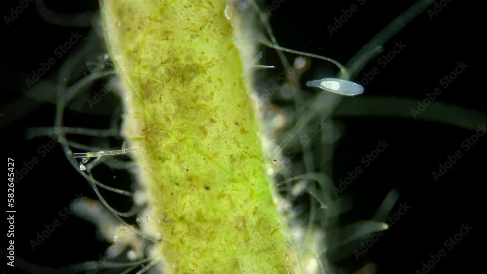 A worm (flatworm) of the Dalyelliidae family under a microscope ...
