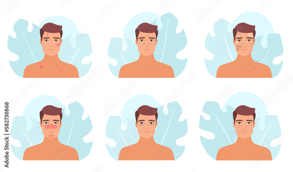 Male skin problem set vector illustration. Cartoon man with different ...
