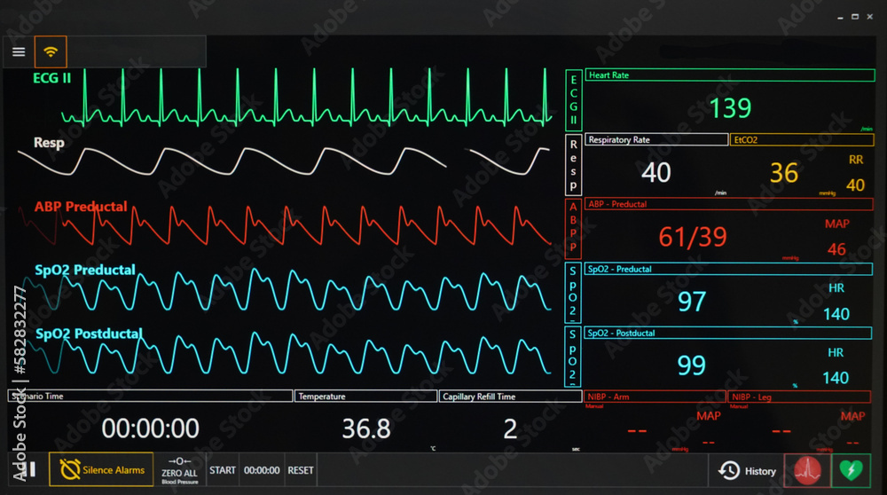 Control room of the pediatric resuscitation simulation course. Stock ...