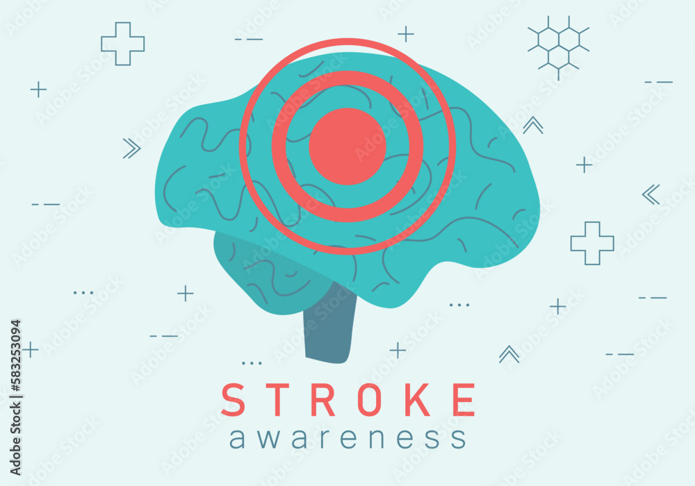 Stroke awareness. Prevention for stroke. Transient ischemic attack ...