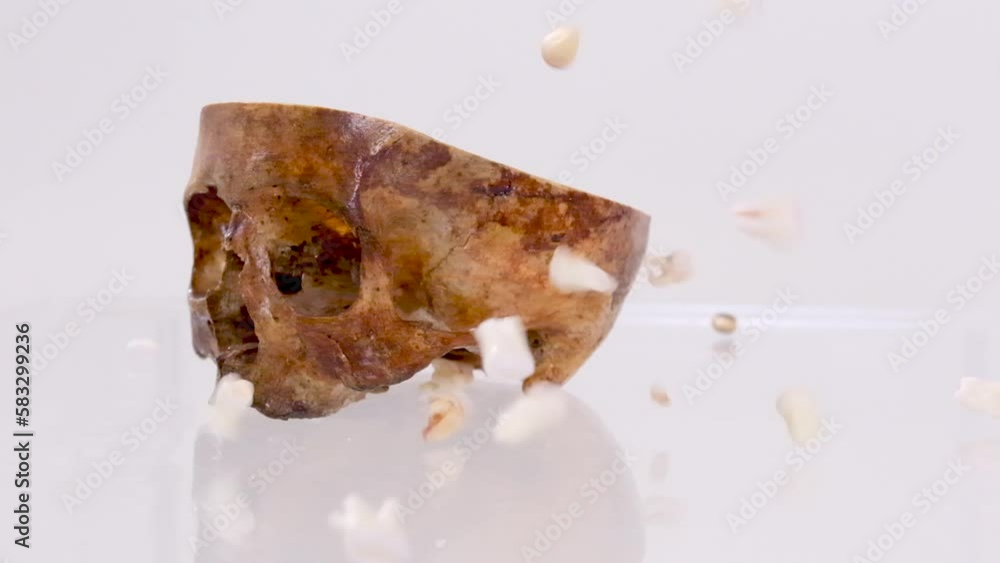 slow motion real human teeth falling crumbling bouncing near a real ...