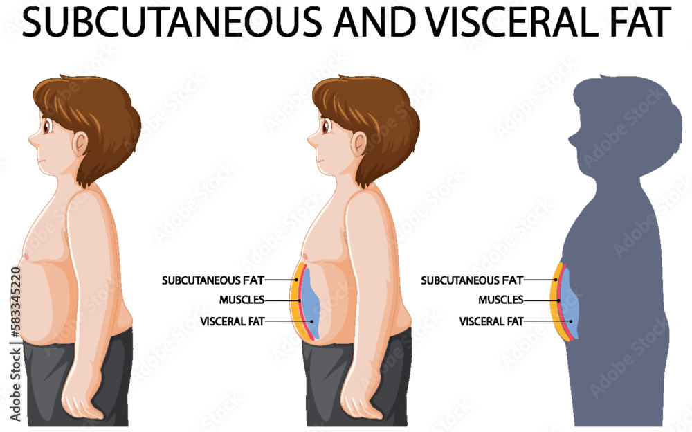 Subcutaneous and visceral fat diagram Stock Vector | Adobe Stock