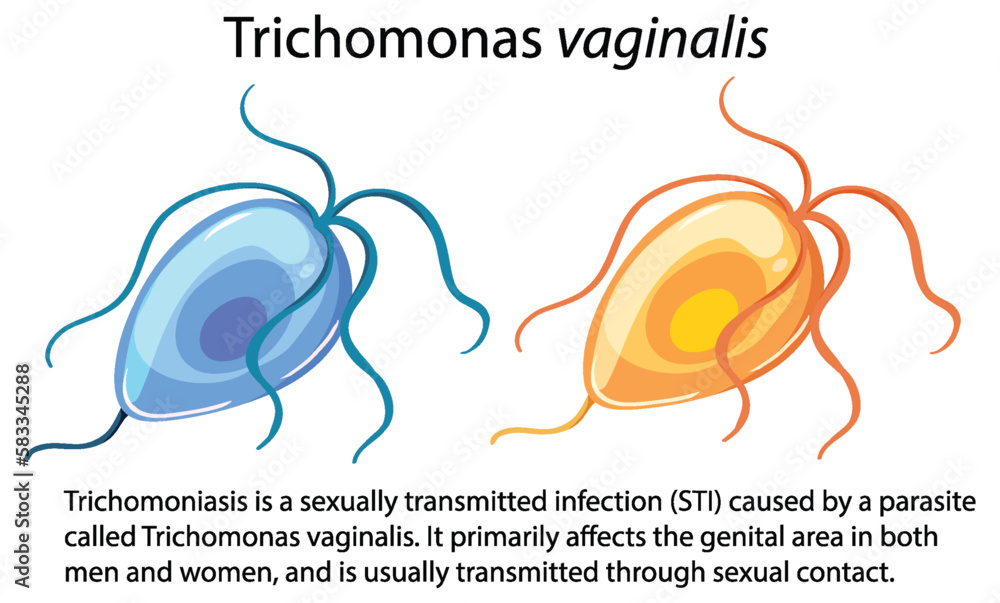 Plakát Trichomonas vaginalis with explanation – Obraz na Zeď | Posters.cz