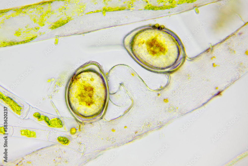 Microscopic view of freshwater algae filament at propagation stage ...