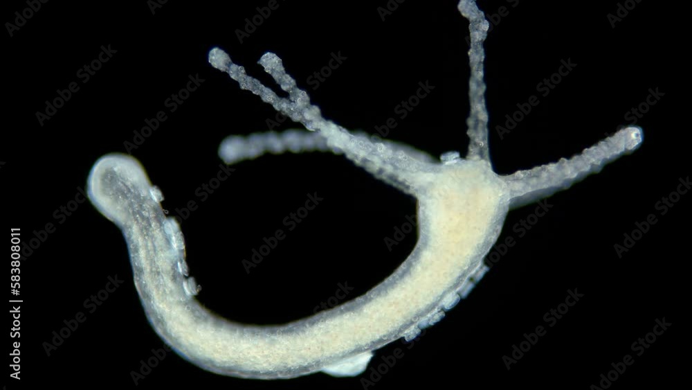 Freshwater Hydra, class Hydrozoa and Infusoria Ciliophora Kerona ...