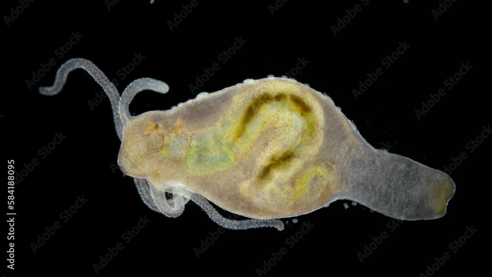 Hydra, Hydrozoa and Infusoria Kerona polyporum, Trichodina under ...