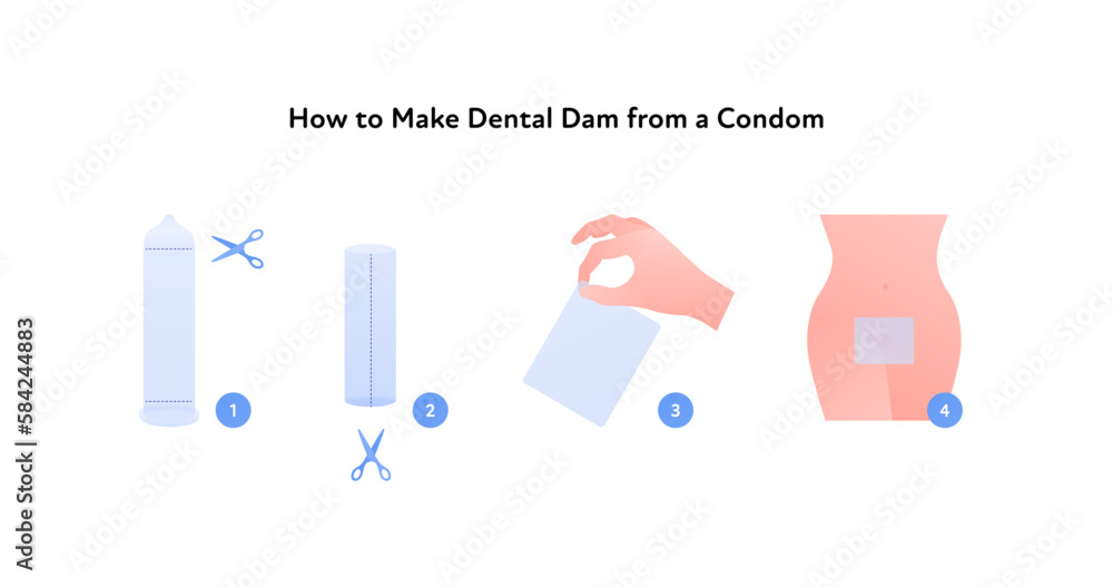 Vecteur Stock Sexual Transmitted Disease Infographic Vector Flat