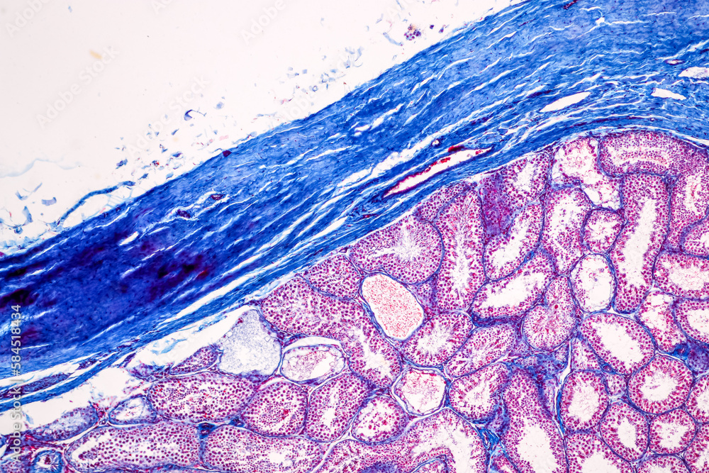 Anatomy and Histological Epididymis and Testis human cells under ...