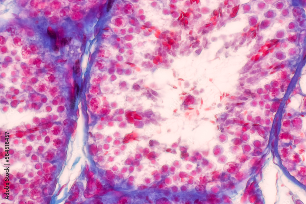 Anatomy and Histological Epididymis and Testis human cells under ...